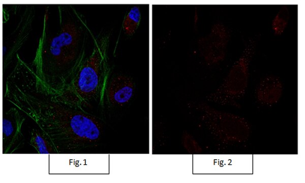 Anti-Sox9 Antibody, Alexa Fluor® 555 conjugate | AB5535-AF555